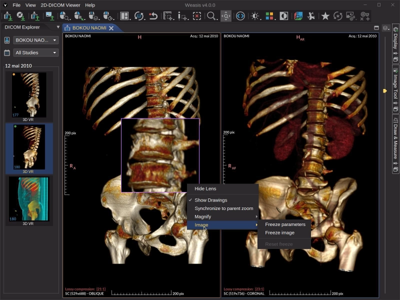 Weasis DICOM Medical Viewer 4.5.1 | Image Viewing Software Weasis DICOM Medical Viewer 4.5.1 | Image Viewing Software
