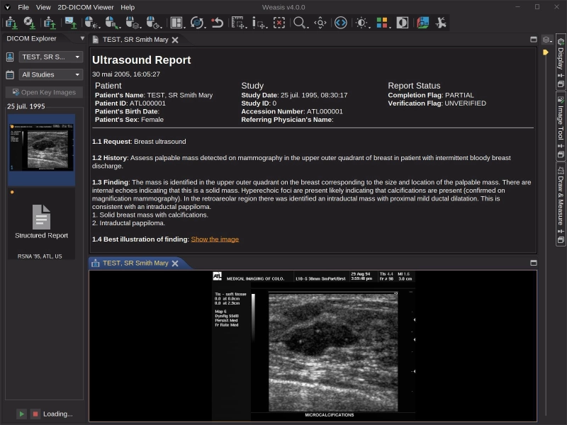 Weasis DICOM Medical Viewer 4.5.1 | Image Viewing Software Weasis DICOM Medical Viewer 4.5.1 | Image Viewing Software